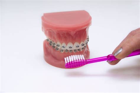 Pick The Right Toothbrush For Braces The Braces Practice