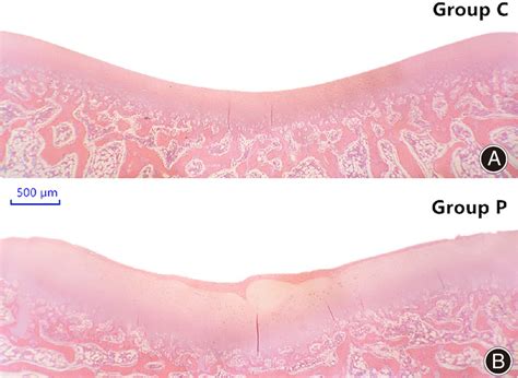 Microscopic View Of Femoral Trochlear Groove In The Two Groups 3 Months