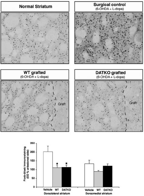 Analysis Of Fosb Á Fosb Striatal Expression High Magnification