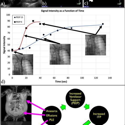 Comparison Of Td Emtying Rates In High And Low Peep And The Cycle Of