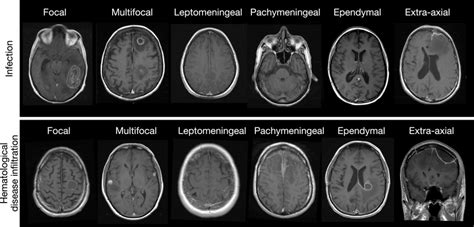 Case Examples Of Anatomical Imaging Classification In Mri Head Studies