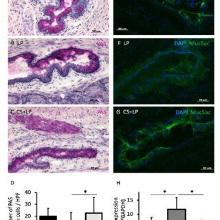Conjunctival Goblet Cell Periodic Acid Schiff Pas Staining Muc5