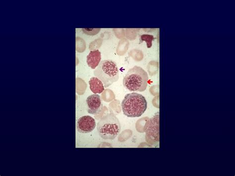 Anemia Classification And Pathogenesis Ppt