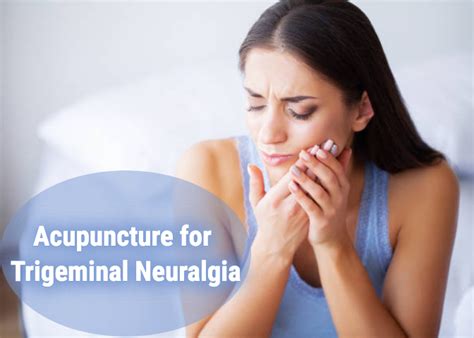 Can Acupuncture Help With Trigeminal Neuralgia Research Says Yes