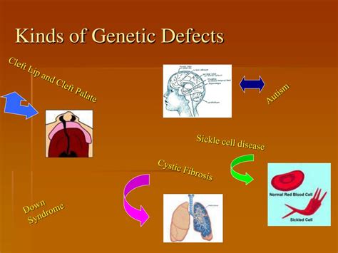 Ppt Genetic Defects Powerpoint Presentation Free Download Id 553106