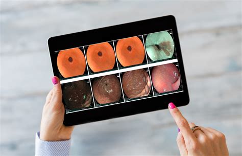 6 Fantastic Benefits Of Dicom Compliant In Endoscopy Software For