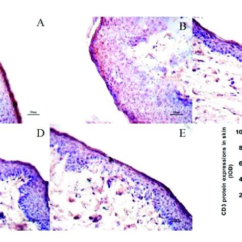 Positive Expression Of Cd3 In Skin Tissue Immunohistochemical Download Scientific Diagram