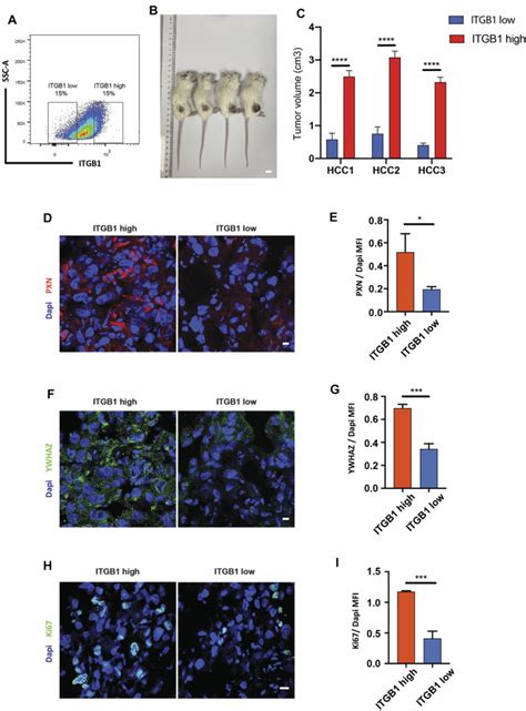 Itgb1 Drives Hepatocellular Carcinoma Progression By Modulating Cell