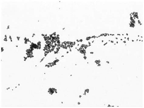 Pediococcus Pentosaceus Jqi 7 Strain And Application Thereof Eureka