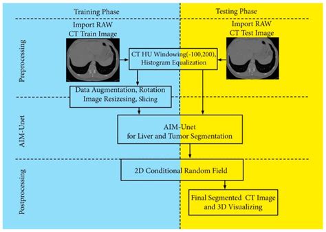 Liversegmentation Tumorsegmentation Unet Deeplearning Bioengineering Mdpi