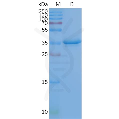 Human Cd20 Full Length Protein Synthetic Nanodisc Dima Biotechnology