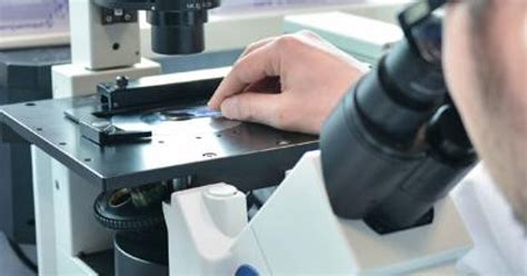 Novità Per Emofilia Linfoma Mieloma Ed Emoglobinuria Il Giornale D