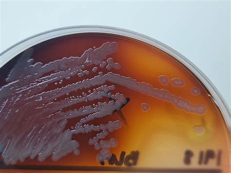 Pyomelanin Production In Pseudomonas Aeruginosa Rmicrobiology
