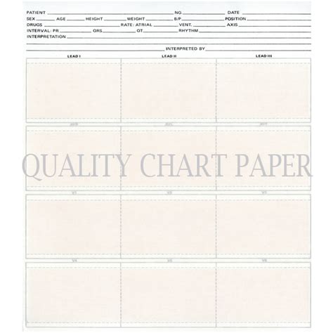 12 Lead Interpretation Chart