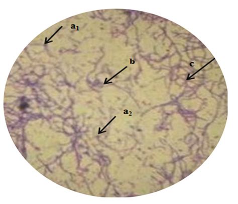 Screening Production And Characterization Of Potential Lignocellulolytic Actinomycetes From
