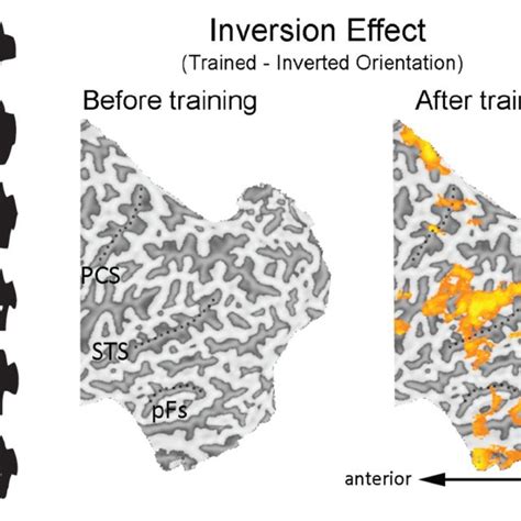 Left An Example Subjects Right Fusiform Face Area Ffa And Right Download Scientific Diagram