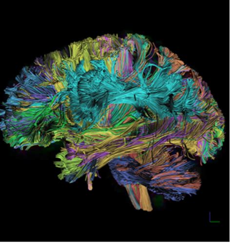Biomedical Imaging School Of Engineeringschool Of Engineering Vanderbilt University