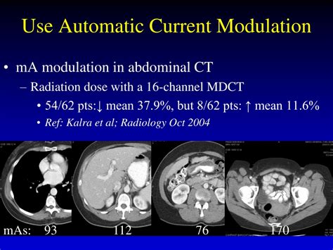 Ppt Strategies For Reducing Radiation Dose In Ct Powerpoint
