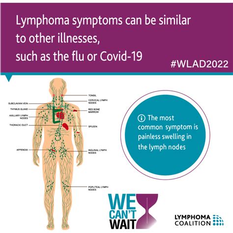 Non Hodgkins Lymphoma Cansa The Cancer Association Of South Africa