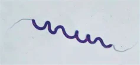 Micro Lab Ex 9 Structural Stains Flashcards Quizlet