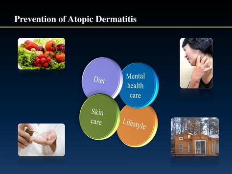 Ppt Causes And Treatment Of Atopic Dermatitis Powerpoint Presentation