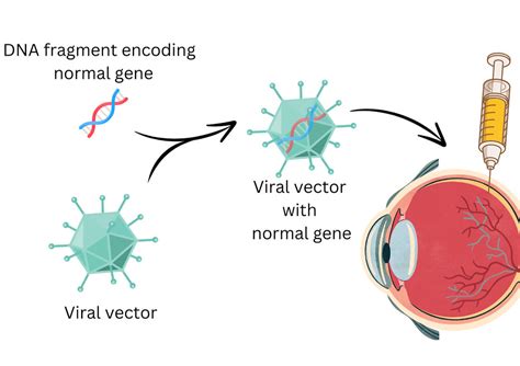 From Darkness To Light Gene Therapy Breakthrough Offers Hope For