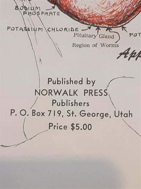 Vintage Colon Therapy Chart Poster Norwalk Press C 1954 N W Walker