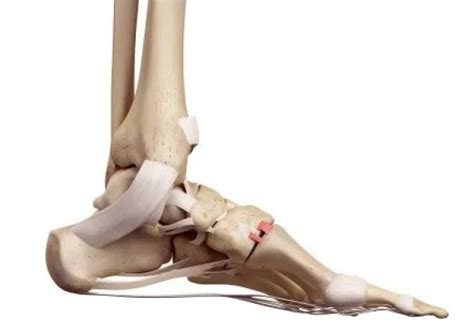 Dont Use 2 Cpt® Codes When 1 Will Do Orthopedic Coding