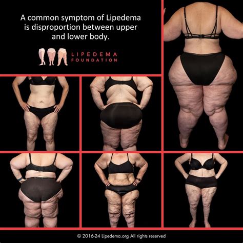 Gs Therapies Clinic Newcastle West