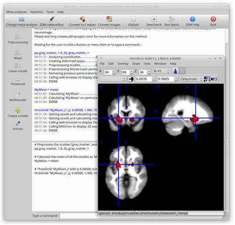 Meta Analysis Tools Mind Lab