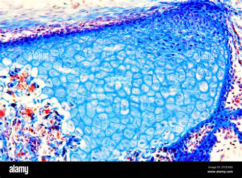 Elastic Cartilaginous Tissue From The Ear Showing Chondrocytes Elastin