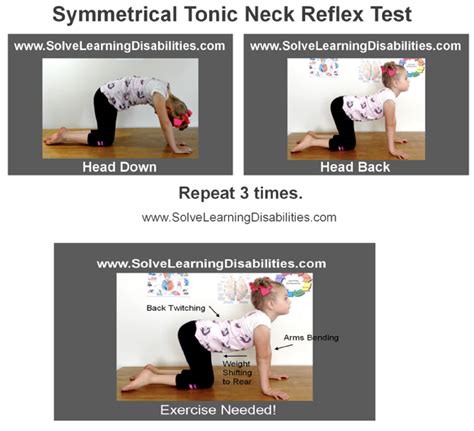 Reflex Integration North Valley Pediatric Therapy