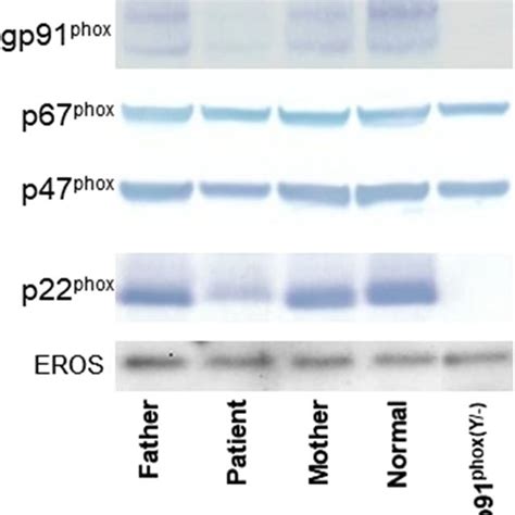 Luminol‐enhanced Chemiluminescence Assay For Nadph Oxidase Activity