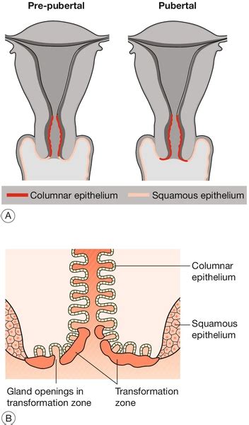 Cervix Anatomy Transformation Zone Cervix Anatomy Transformation Zone