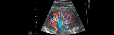 What Is The Difference Between Ultrasound And Color Doppler