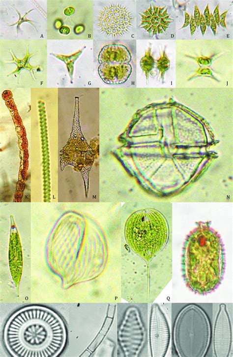 Ankistrodesmus Under Microscope