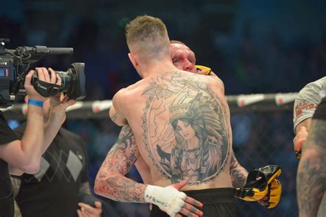 The Severe Spotlight Rhys Mckee