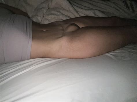Starting To Like My Amputated Look R Labiaplastysurgery