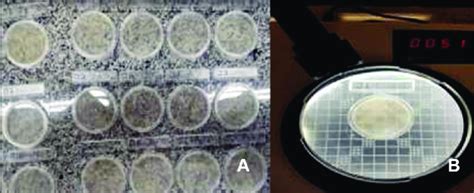 Microbiological Testing A Sample Streaking Using Specific Culture