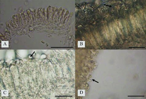 Basidia Cystidia And Basidiospore Of Omphalotus Nidiformis Bo24581 Download Scientific