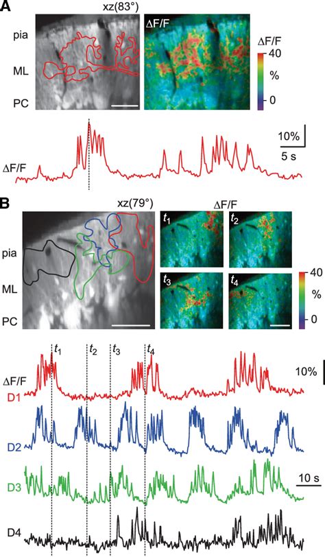Figure 2 From New Angles On Neuronal Dendrites In Vivo Semantic Scholar