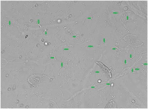 L Forms Seen Under The Light Microscope Marked With Green Arrows