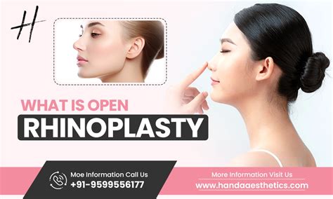 What Is Open Rhinoplasty Dr Shruti Marwah Handa