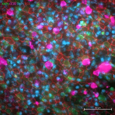 Small Airway Epithelial Cell Model Newcells Biotech