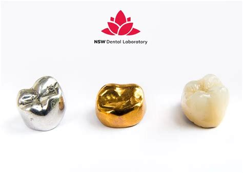 Best Types Of Dental Crown Material Nsw Dental Lab