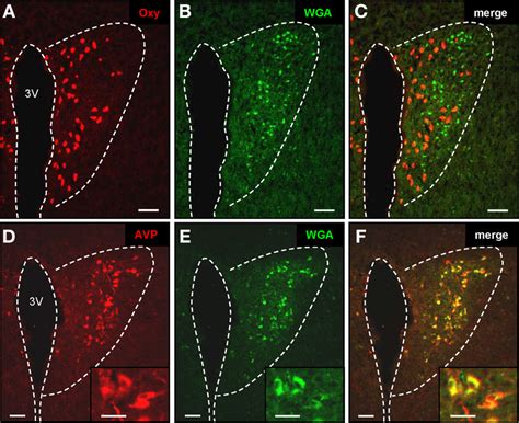 Transsynaptic Labeling Of Vasopressinergic Neurons In The Download Scientific Diagram
