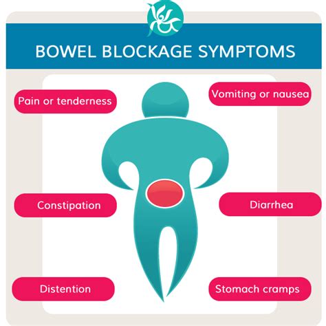 Bowel Blockage Tests At Wendy Hopkins Blog