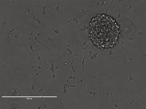 Differentiating Neurons Mesencephalic Neuronal Progenitor Flickr