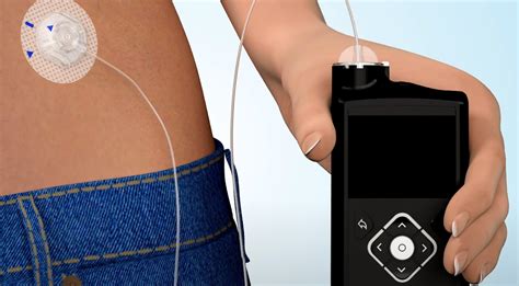 How To Choose Lipo Battery For Medical Device Grepow