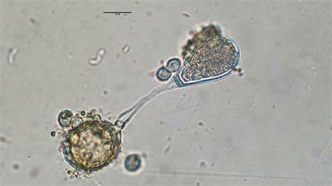 Sex And Garlic New Weapons Against The Most Notorious Vineyard Disease